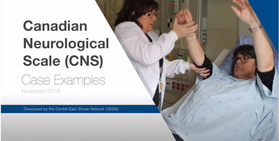 4-24hr EVT Toolkit - Central East Stroke Network